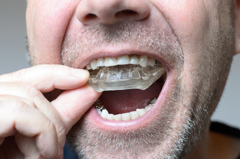 Teeth Grinding and How To Fix It | Stonebrook Family Dental in Aurora ...