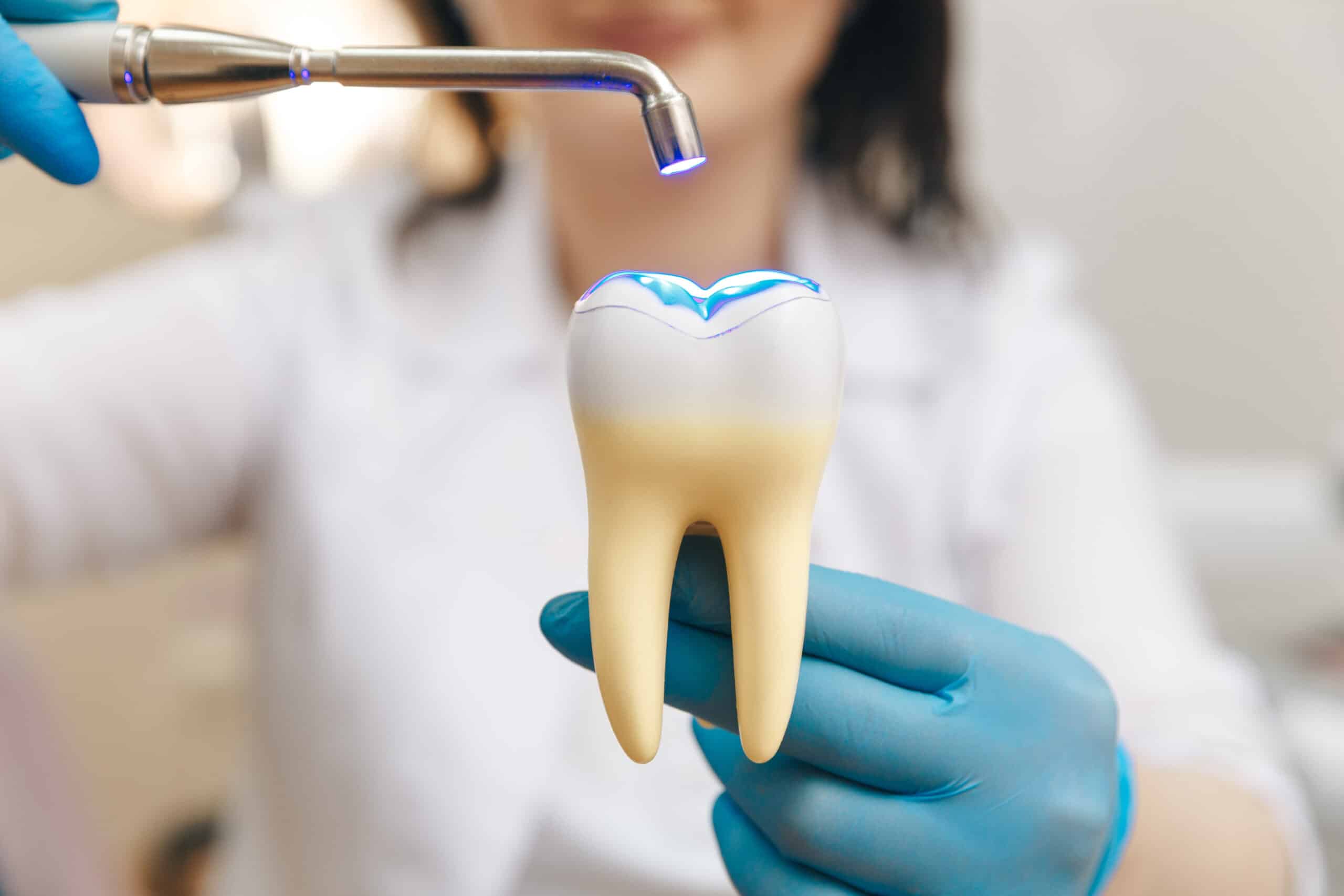 Fight Cavities with Fillings at Stonebrook Family Dental